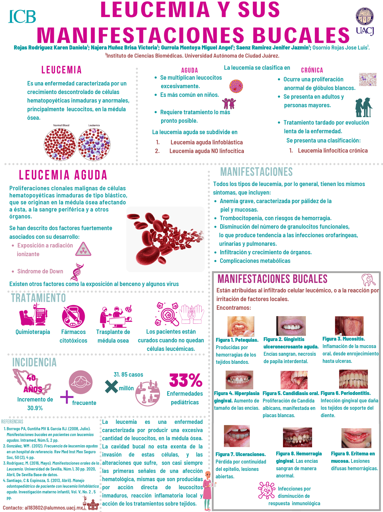 LEUCEMIA Y SUS MANIFESTACIONES BUCALES - Docsity