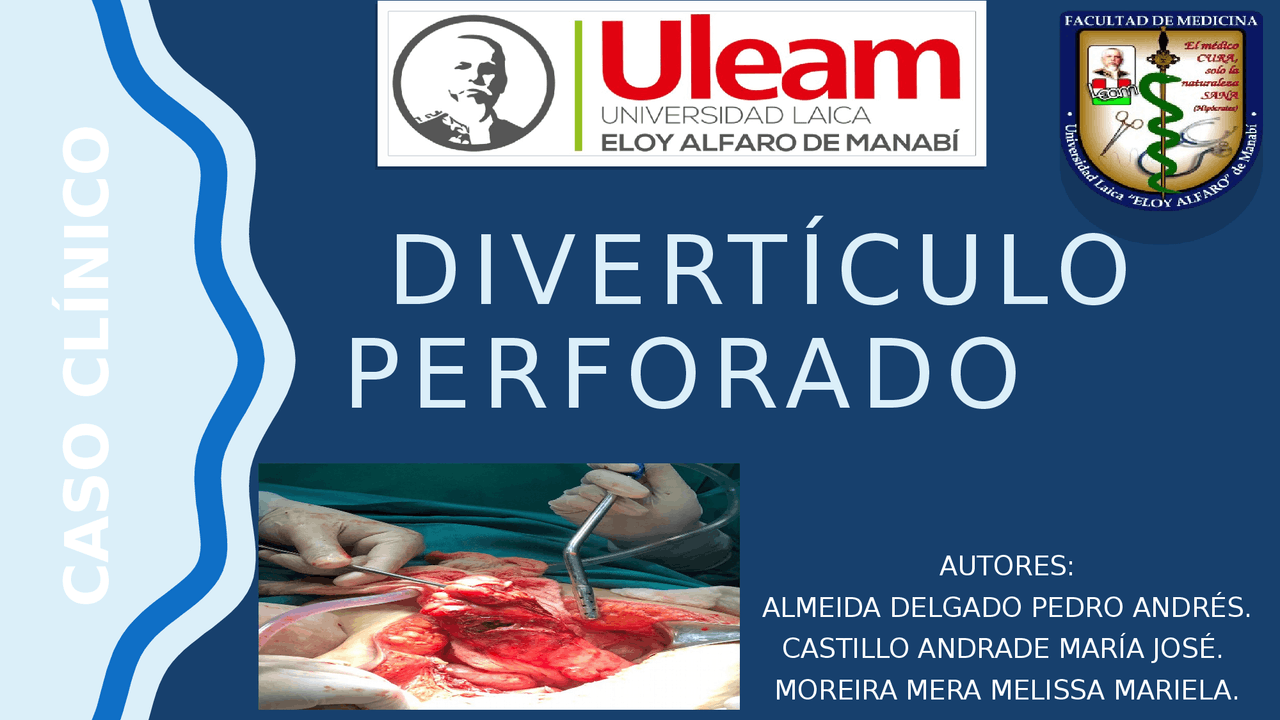 Diverticulo perforado - Docsity