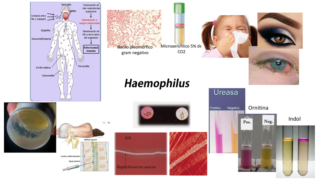 Bacteria Haemophilus - Docsity