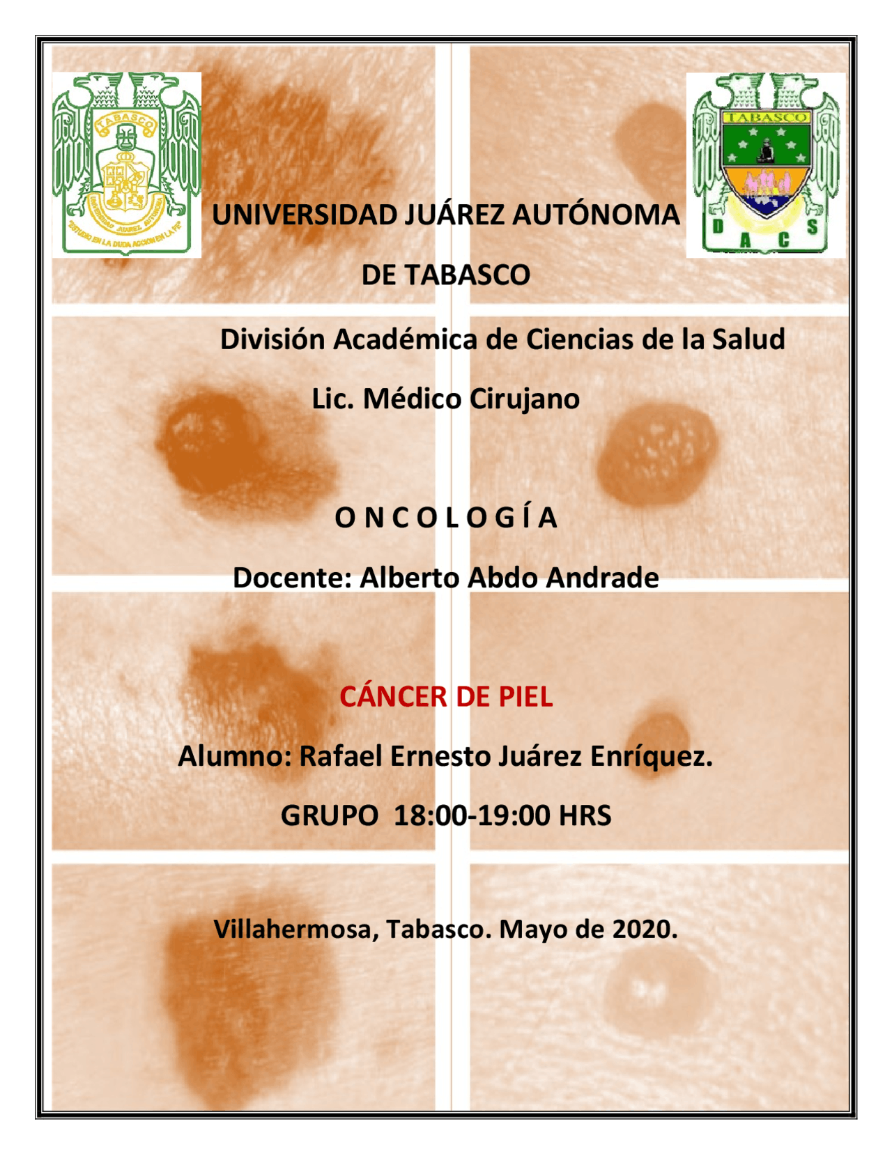 CÁNCER DE PIEL (basocelular, epidermoides) - Docsity