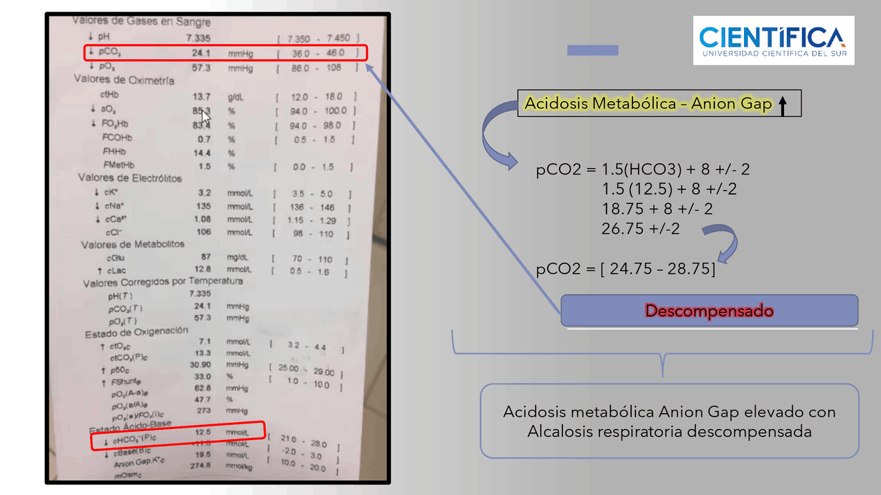 Interpretación de Aga - Docsity