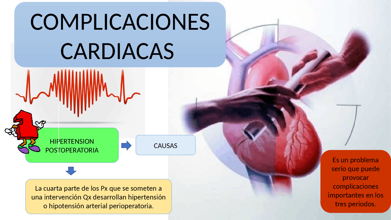 Complicaciones Cardiacas Docsity