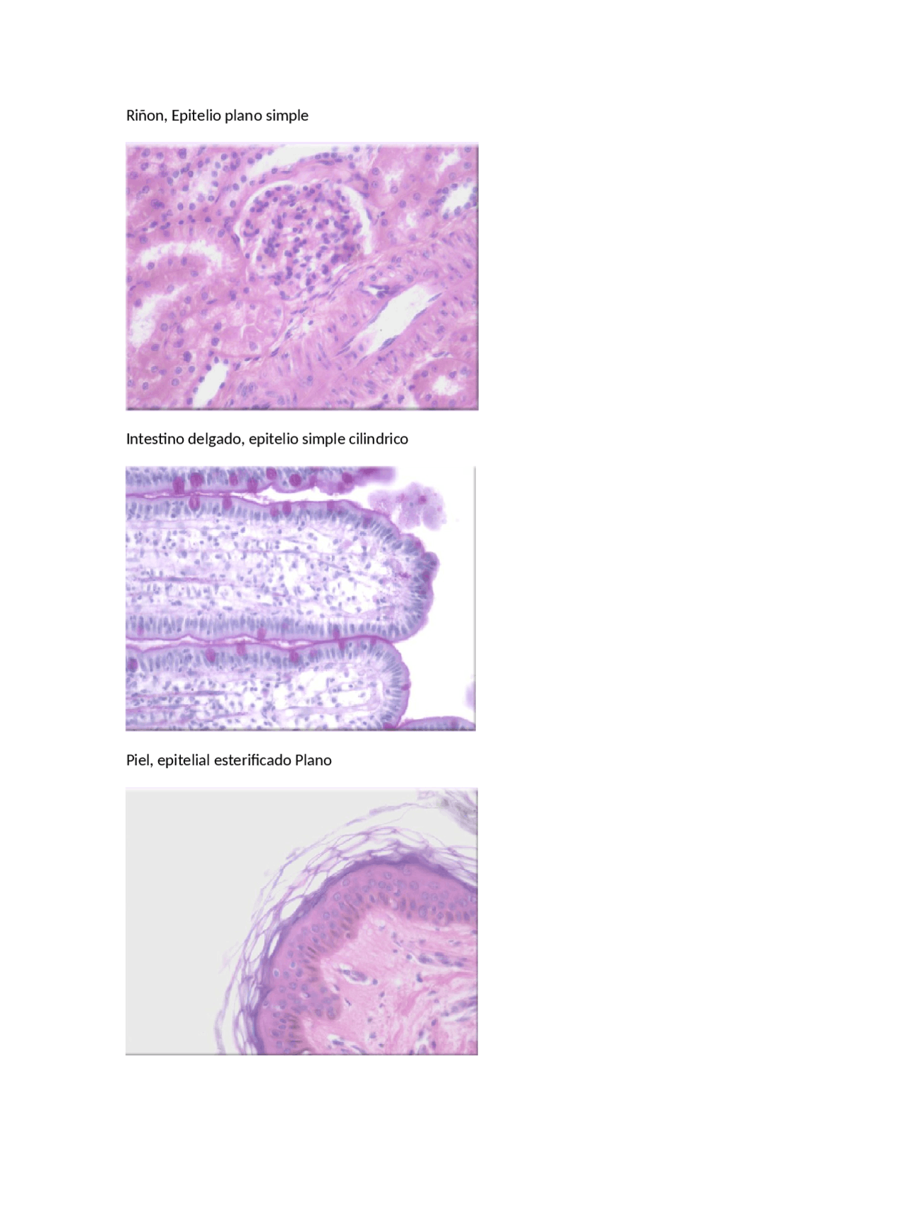 Epitelios Histologia De Ross Docsity
