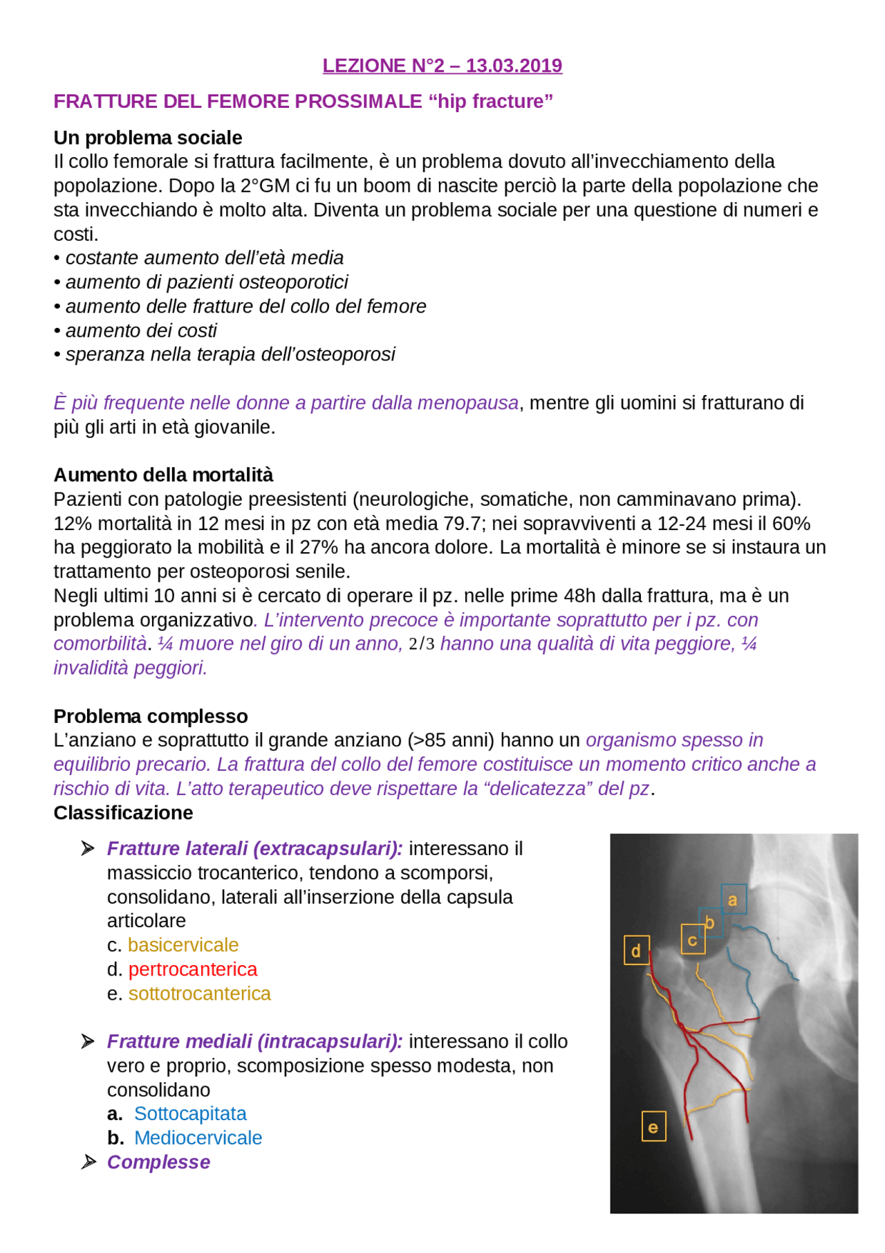 Fratture del femore e lesioni traumatiche - Docsity