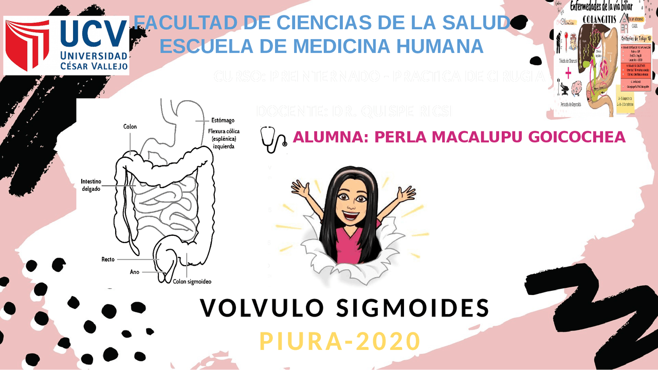 TEMA: VOLVULO SIGMOIDES | Diapositivas de Medicina - Docsity