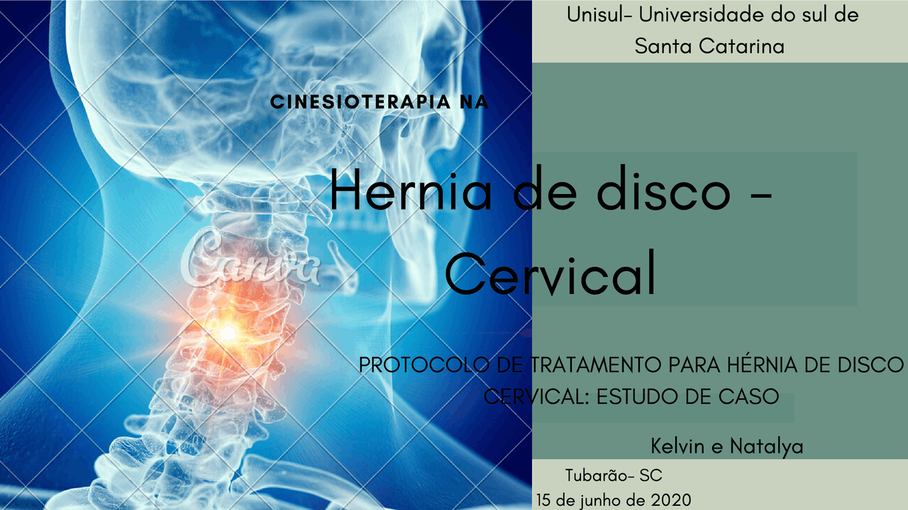 Hernia De Disco Cervical Slides Cinesiologia Docsity