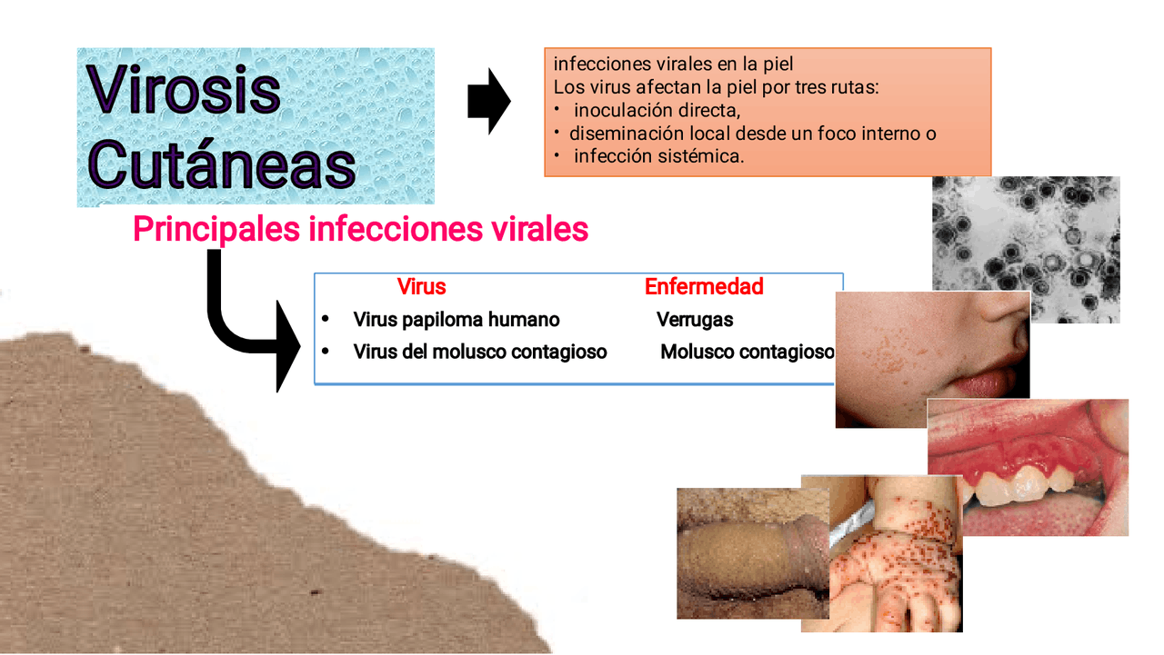 Virosis dermatológicas - Docsity