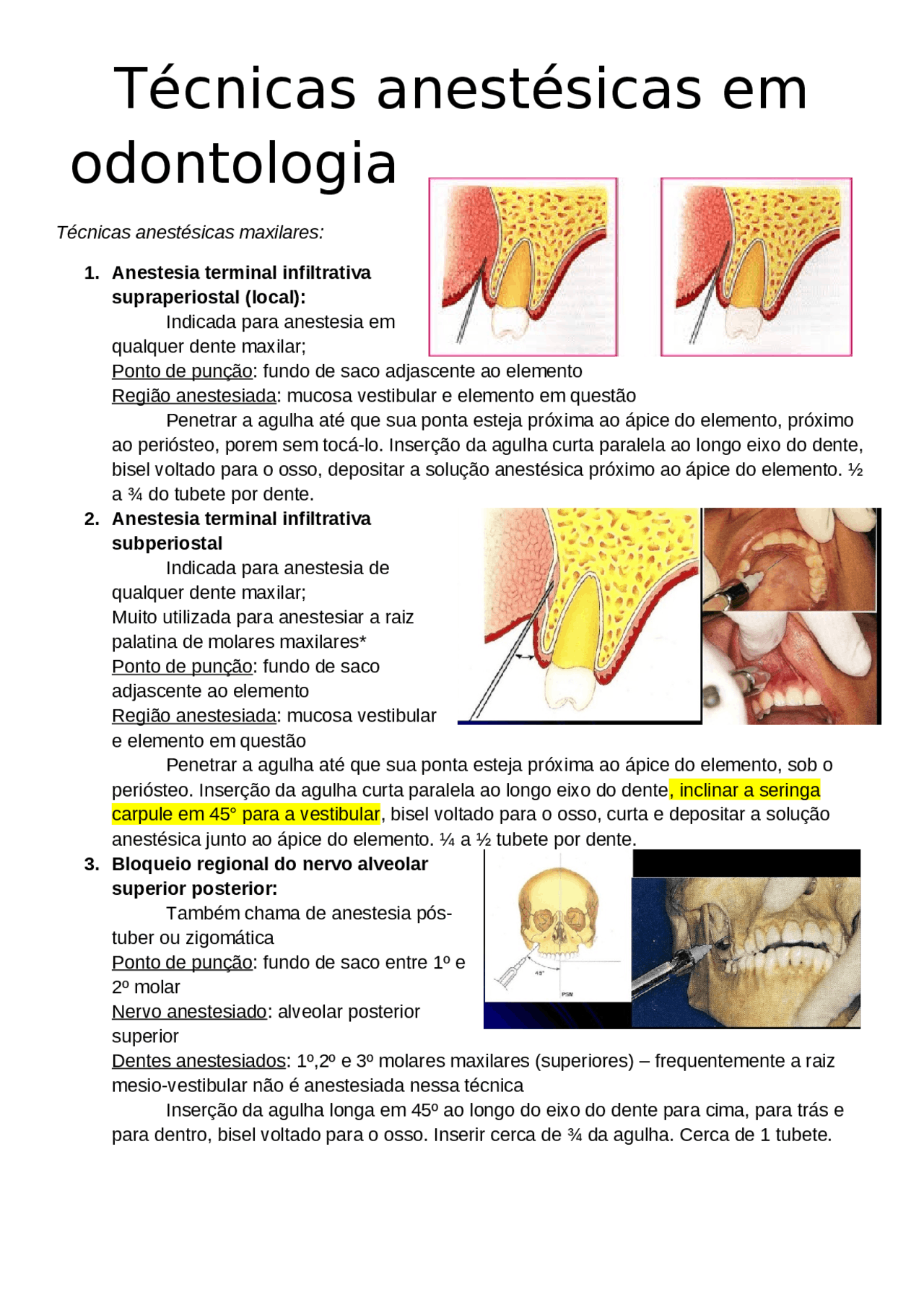Técnicas Anestesicas Docsity