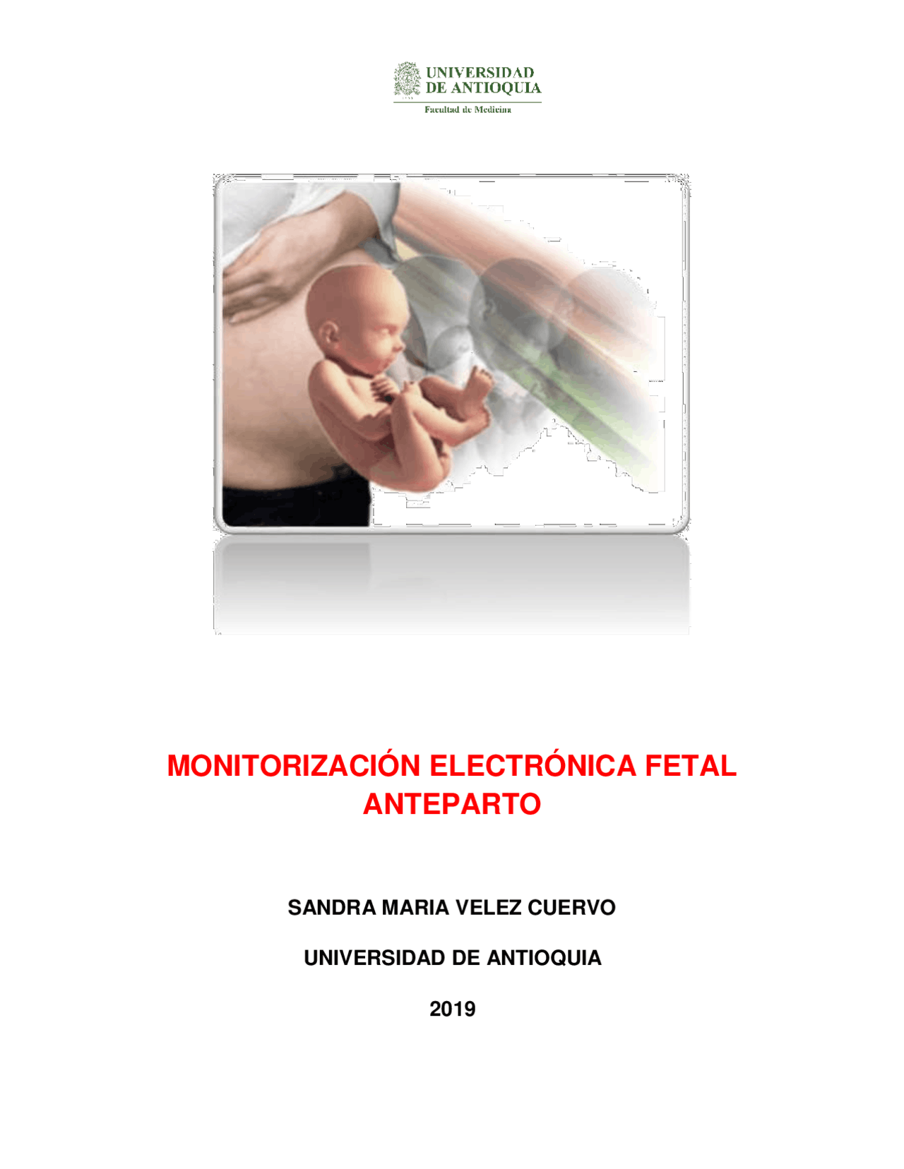 MONITORIZACION ELECTRONICA FETAL ANTEPARTO - Docsity