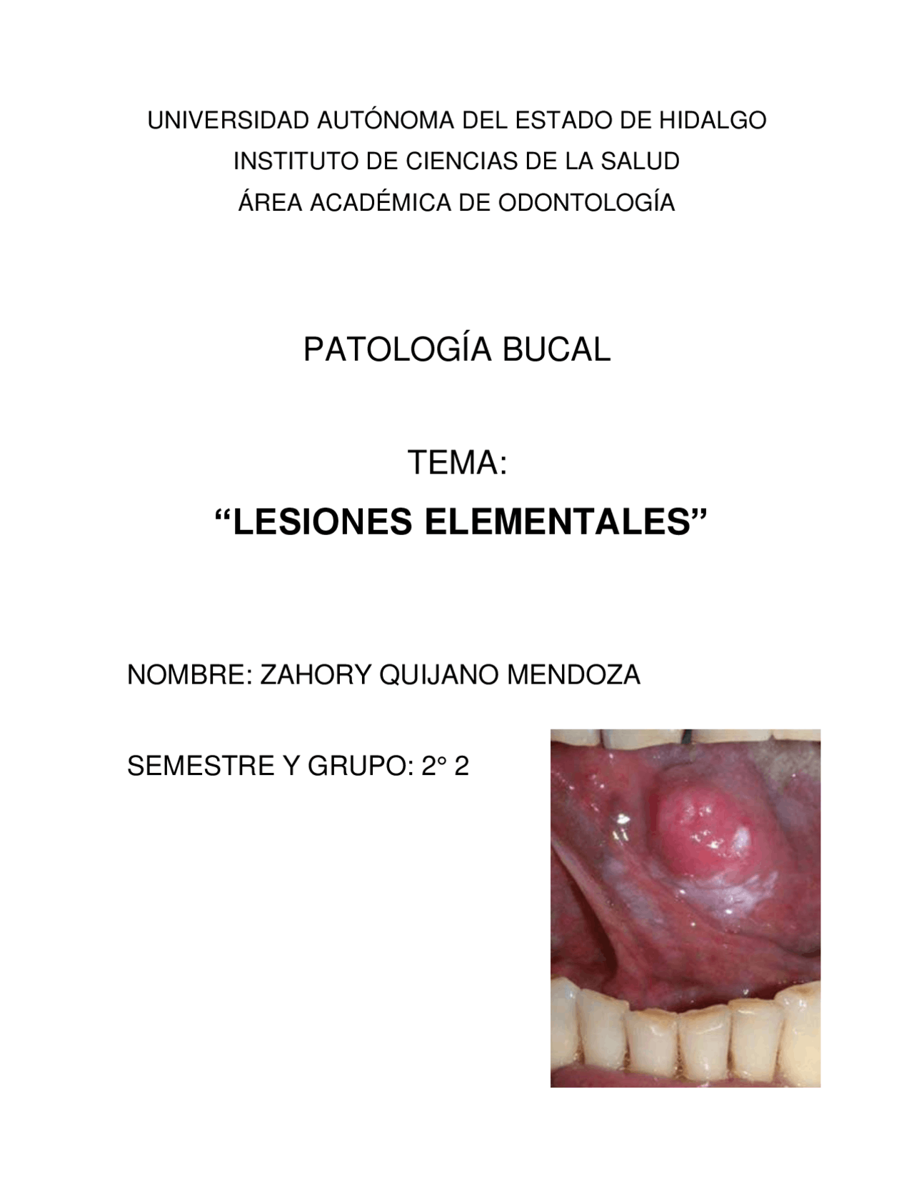 Las lesiones elementales - Docsity