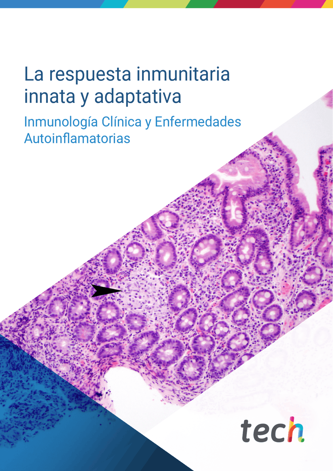 La respuesta inmunitaria innata y adaptativa - Docsity