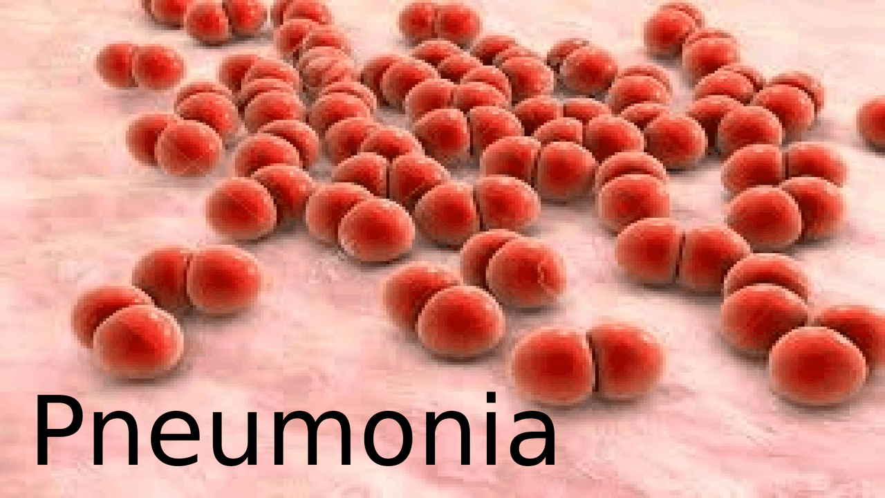 Streptococcus pneumoniae ou informalmente Pneumococo é uma espécie de ...
