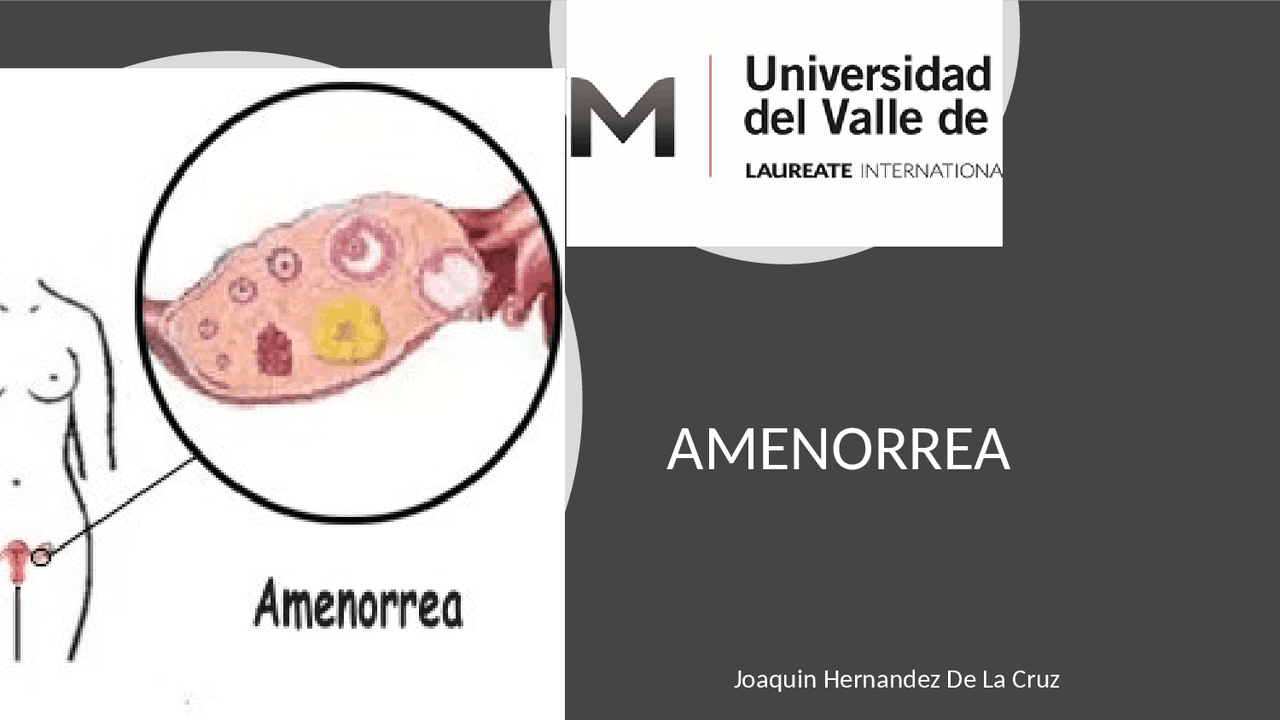 AMENORREA GINECOLOGIA - Docsity