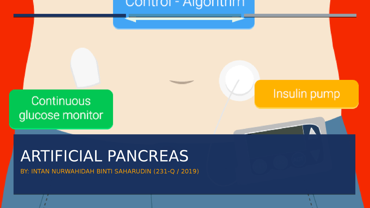 What is Artificial Pancreas? - Docsity