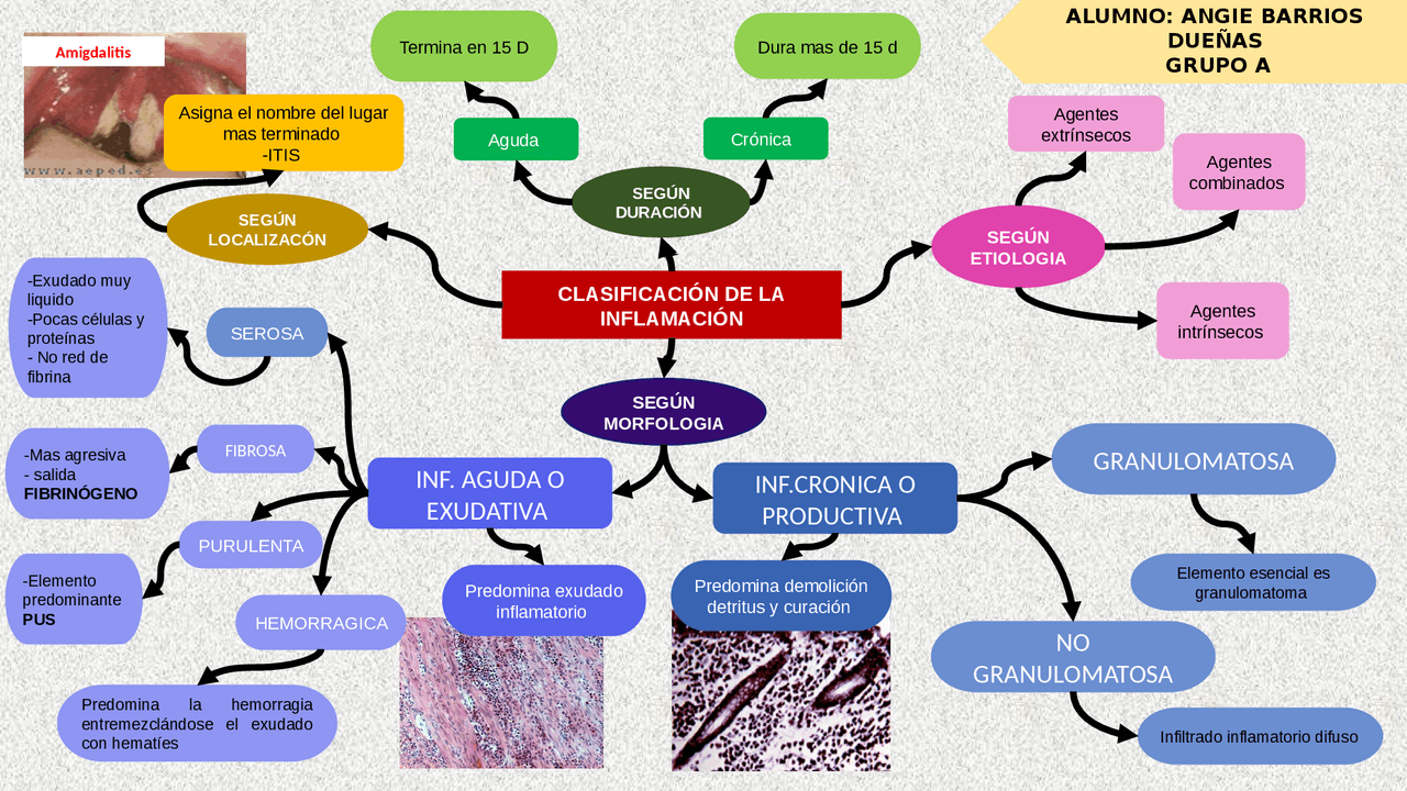 Clasificación De La Inflamación Esquemas Y Mapas Conceptuales De