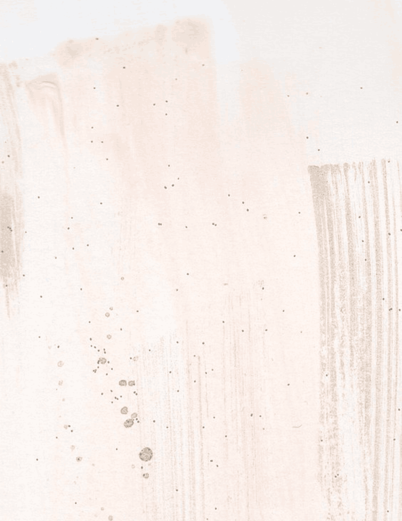 FASES DEL SHOCK, fase progresiva no inicial, fase progresiva | Apuntes ...