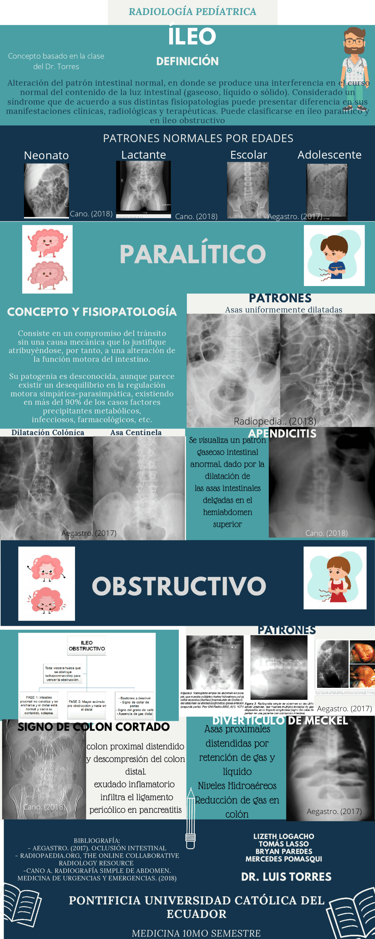 Ileo Paralitico Obstrucción Intestinal, Síntomas Y Causas Que No