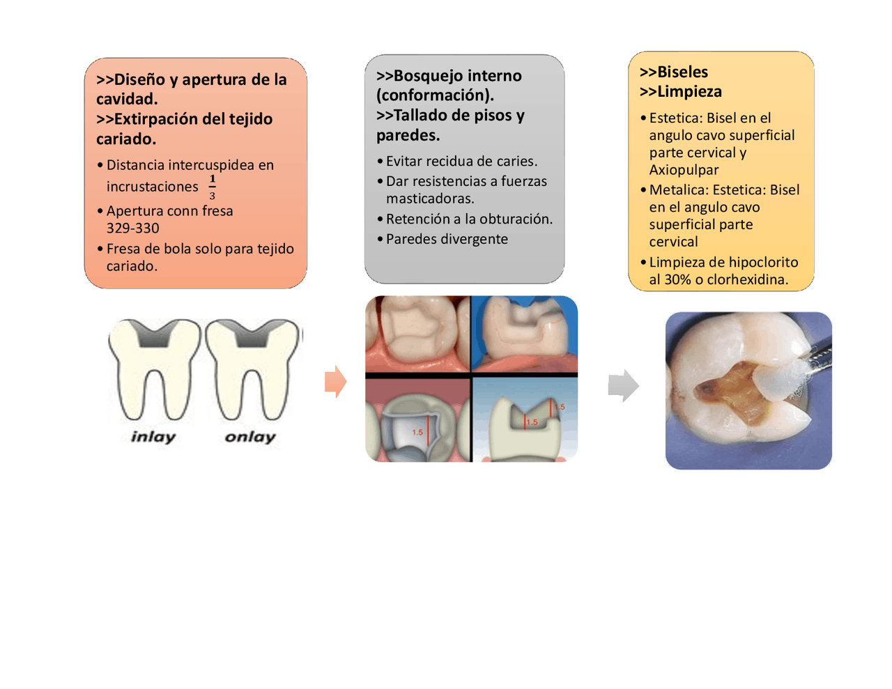 MAPA CONCEPTUAL DE ONLAY E INLAY | Apuntes de Odontología - Docsity