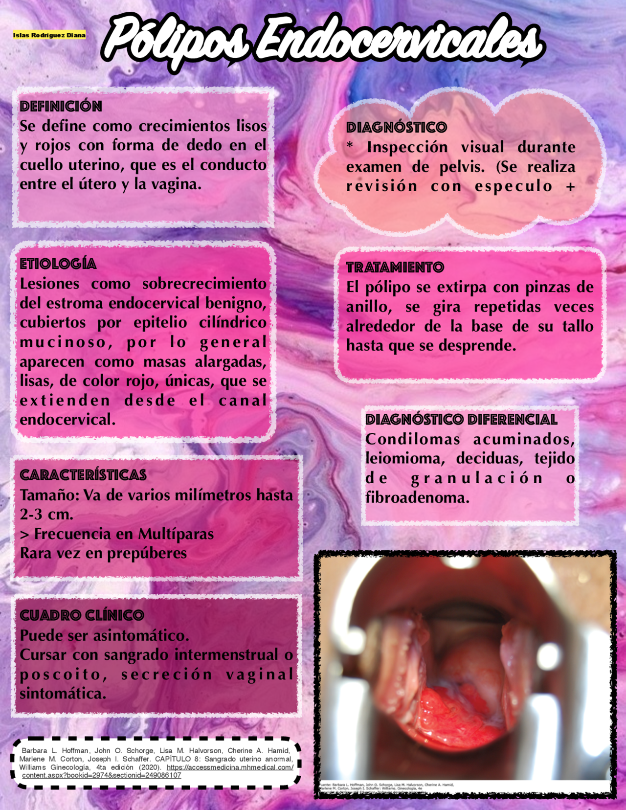 Pólipos Cervicales_Apunte - Docsity