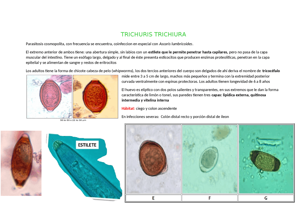 Trichuris trichiura parasito | Apuntes de Parasitología - Docsity