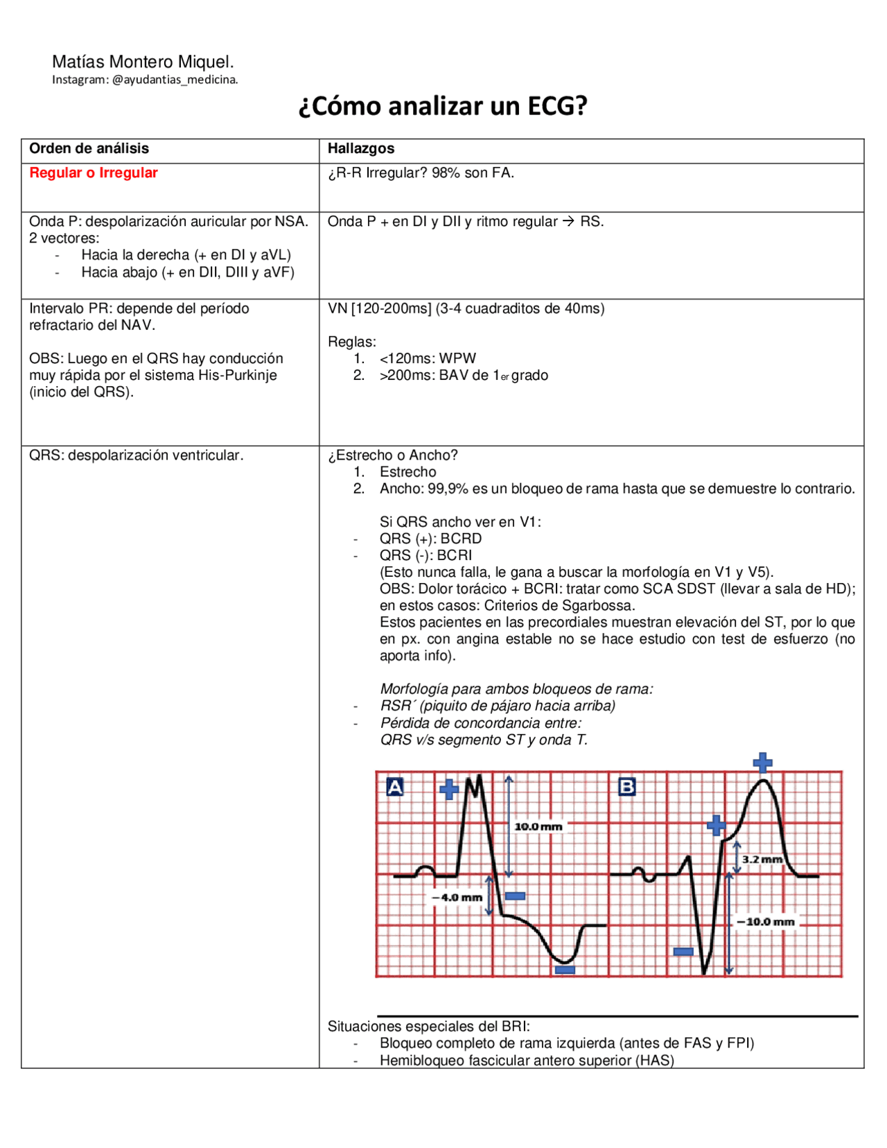 Generalidades ECG: Conceptos básicos para la interpretación de un ...