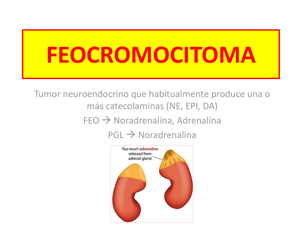 FEOCROMOCITOMA Y PARAGANGLIOMA - Docsity