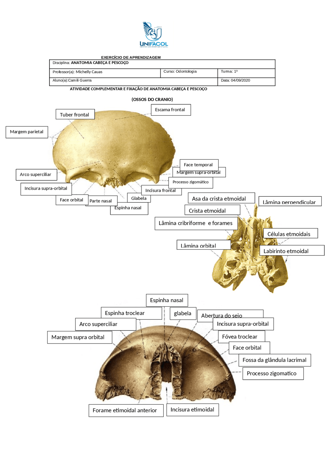 Descrição sobre os ossos da face e da base do cranio | Notas de aula ...