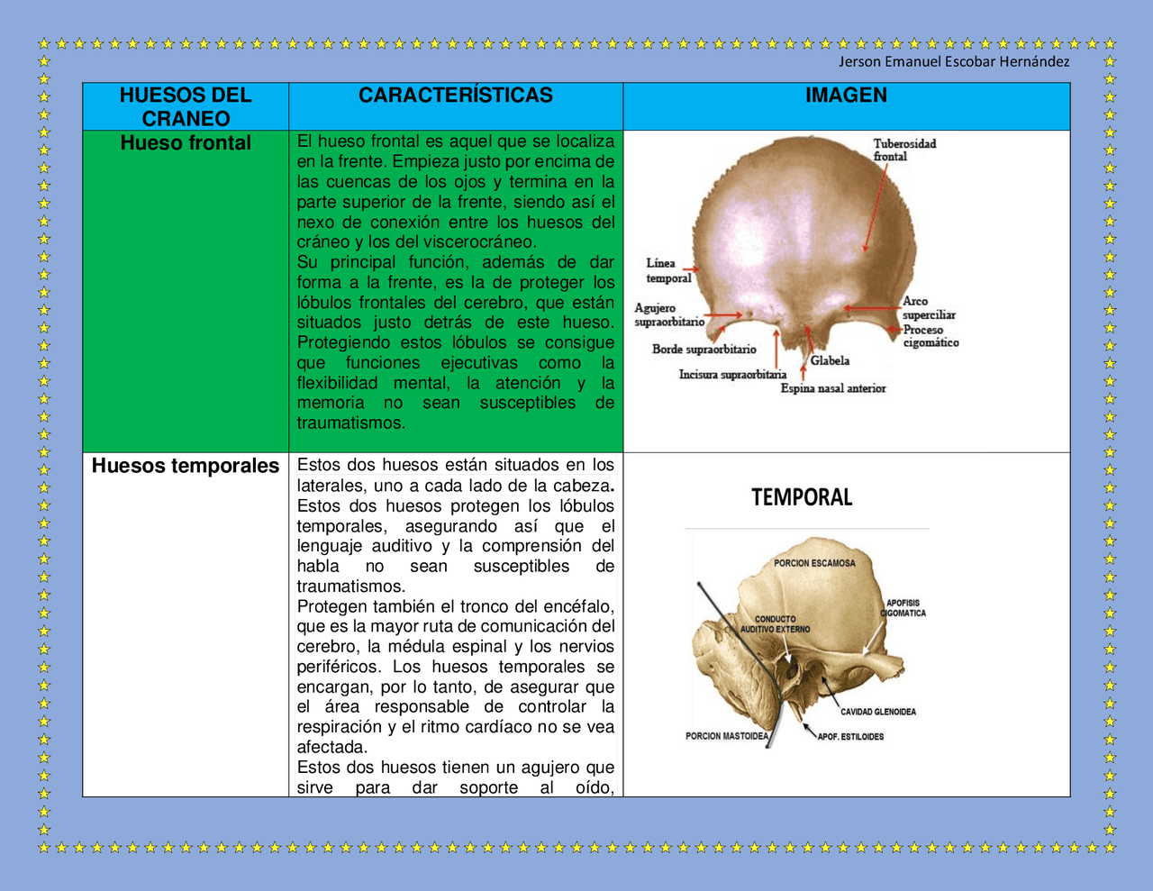 Huesos craneales y del Viscerocraneo - Docsity