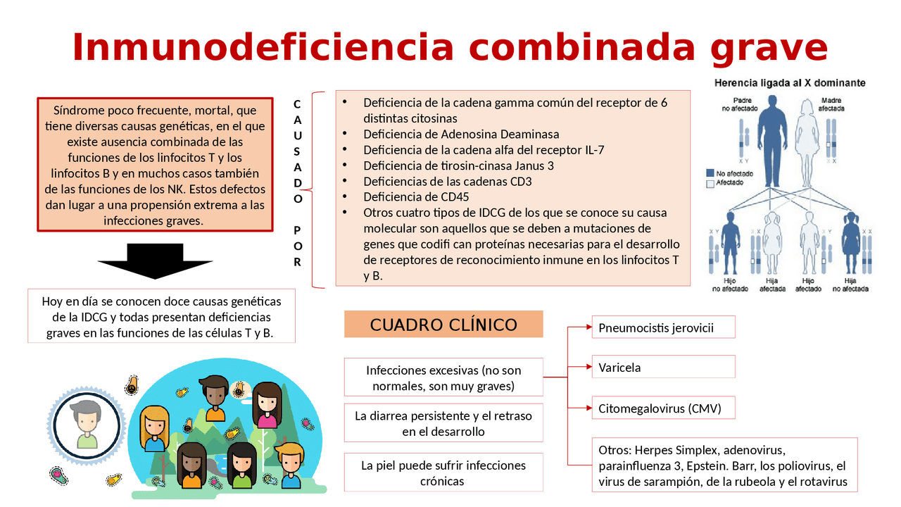 Inmunodeficiencia Combinada Grave Docsity