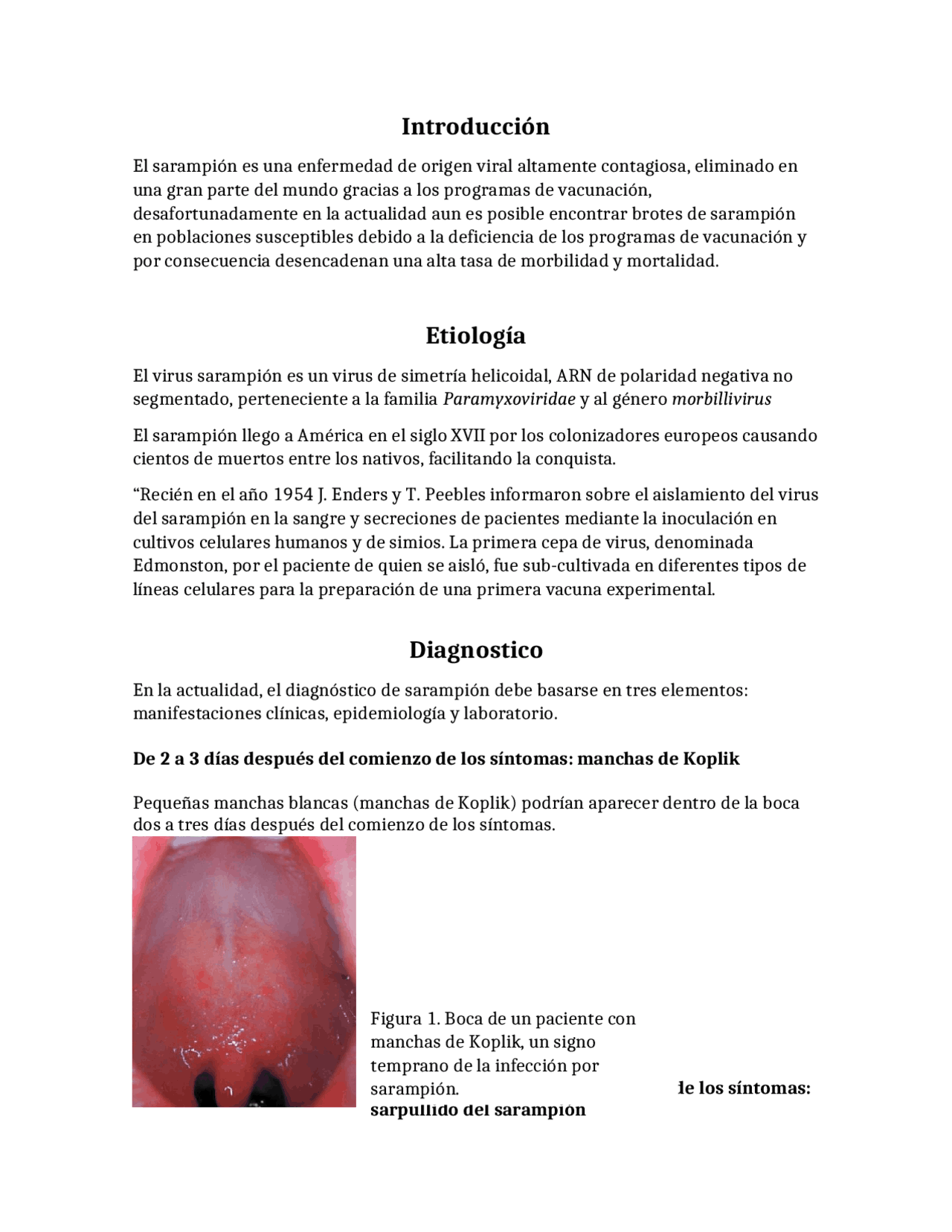 Etiología Del Sarampión Apuntes De Epidemiología Docsity