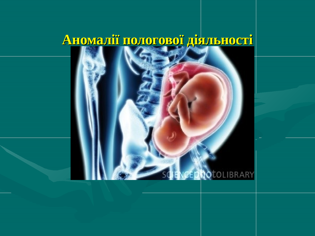 Лекція на тему Аномалії пологової діяльності Docsity