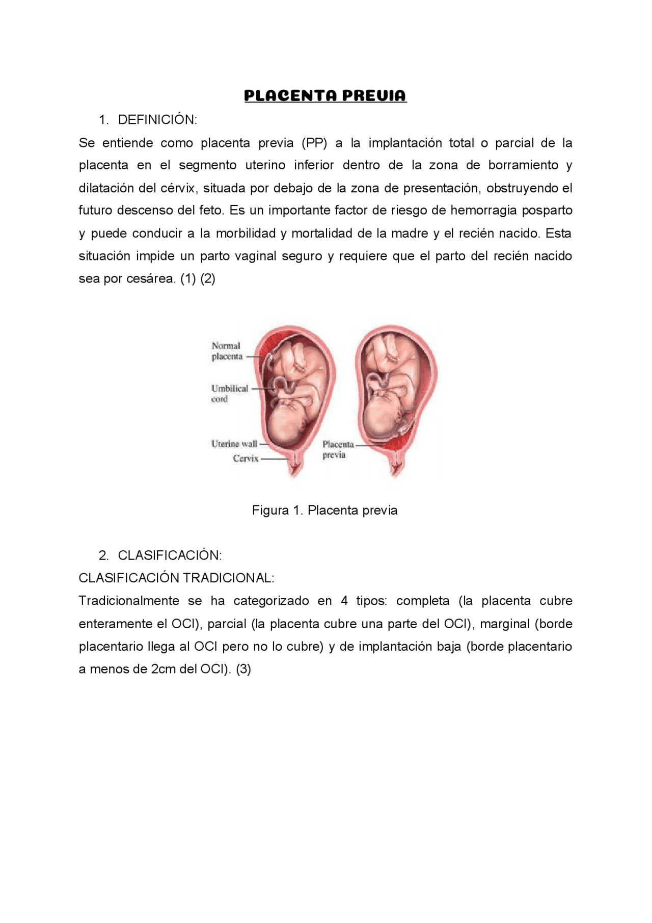 Placenta Previa Embriología Docsity