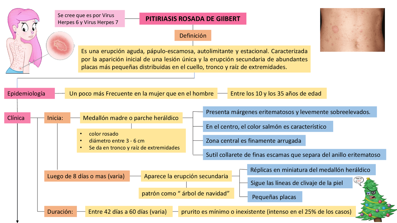 Pitiriasis Rosada de Gilbert - Docsity