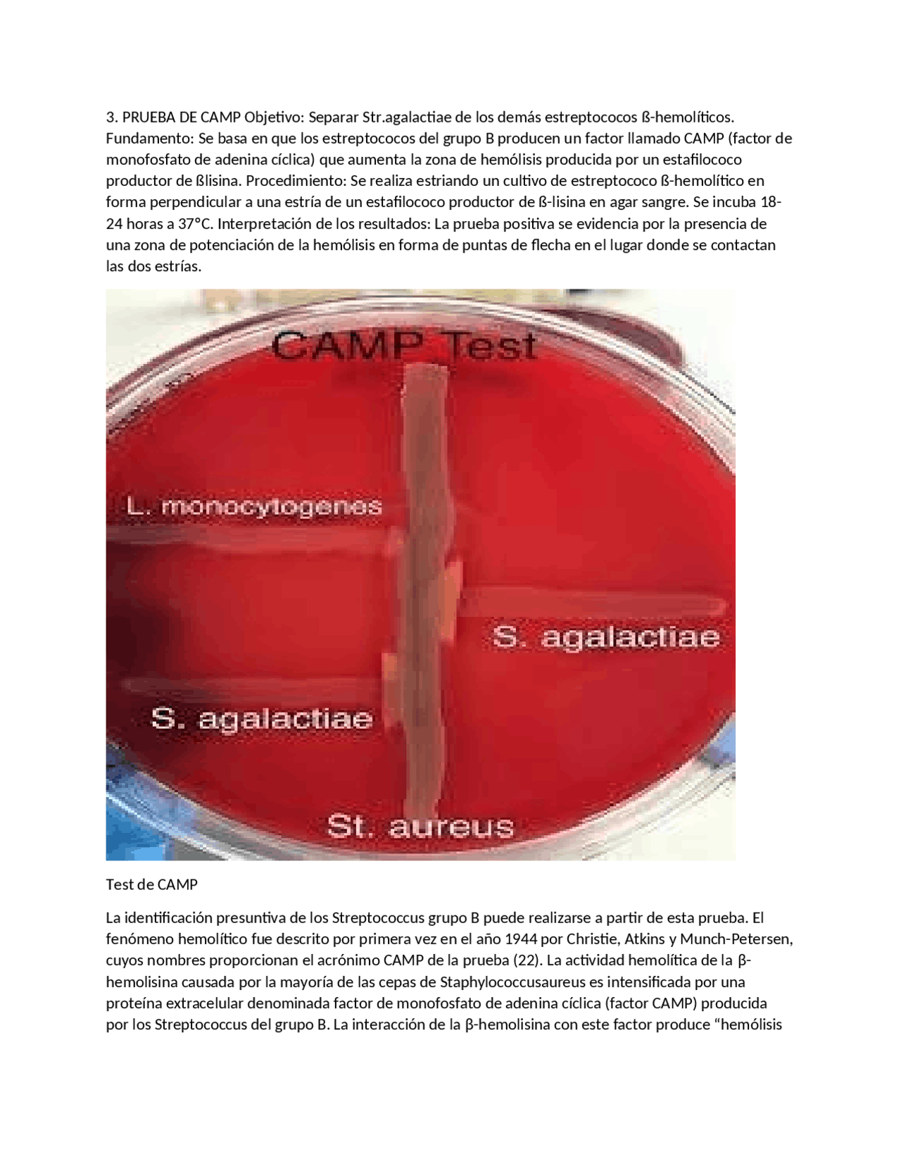 Resumen de la prueba de CAMP | Apuntes de Microbiología Farmacéutica ...