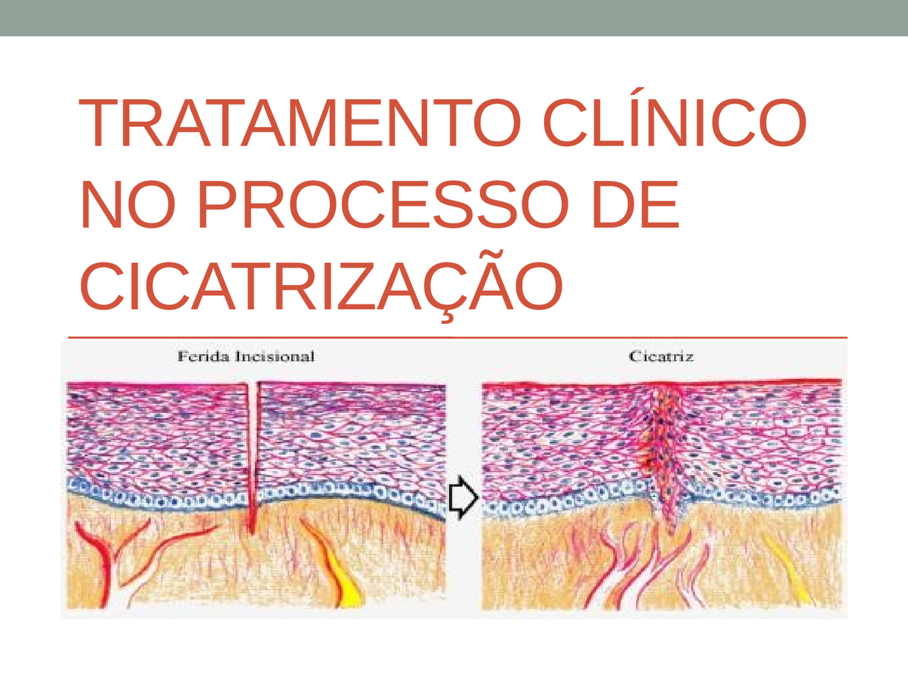 Processo Cicatricial e celulas - Docsity