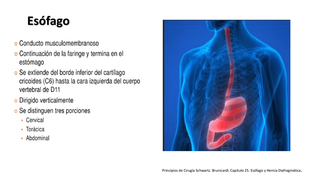 PATOLOGIA QUIRURGICA DEL ESOFAGO | Diapositivas de Cirugía General ...