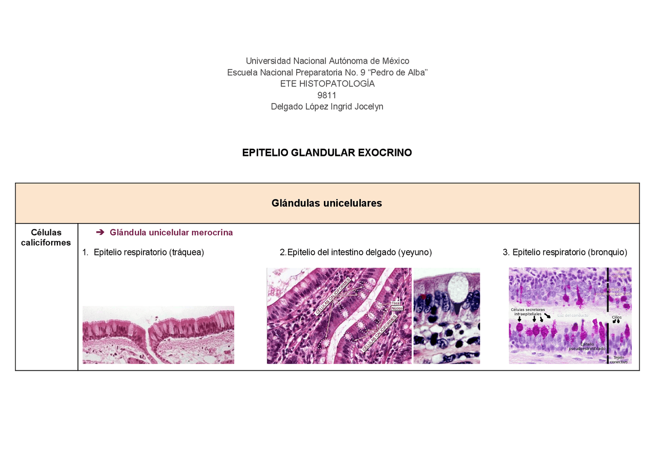 Epitelio Glandular Exocrino Docsity