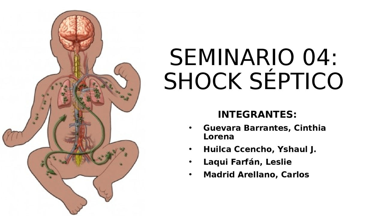 Seminario de shock séptico | Diapositivas de Pediatría | Docsity