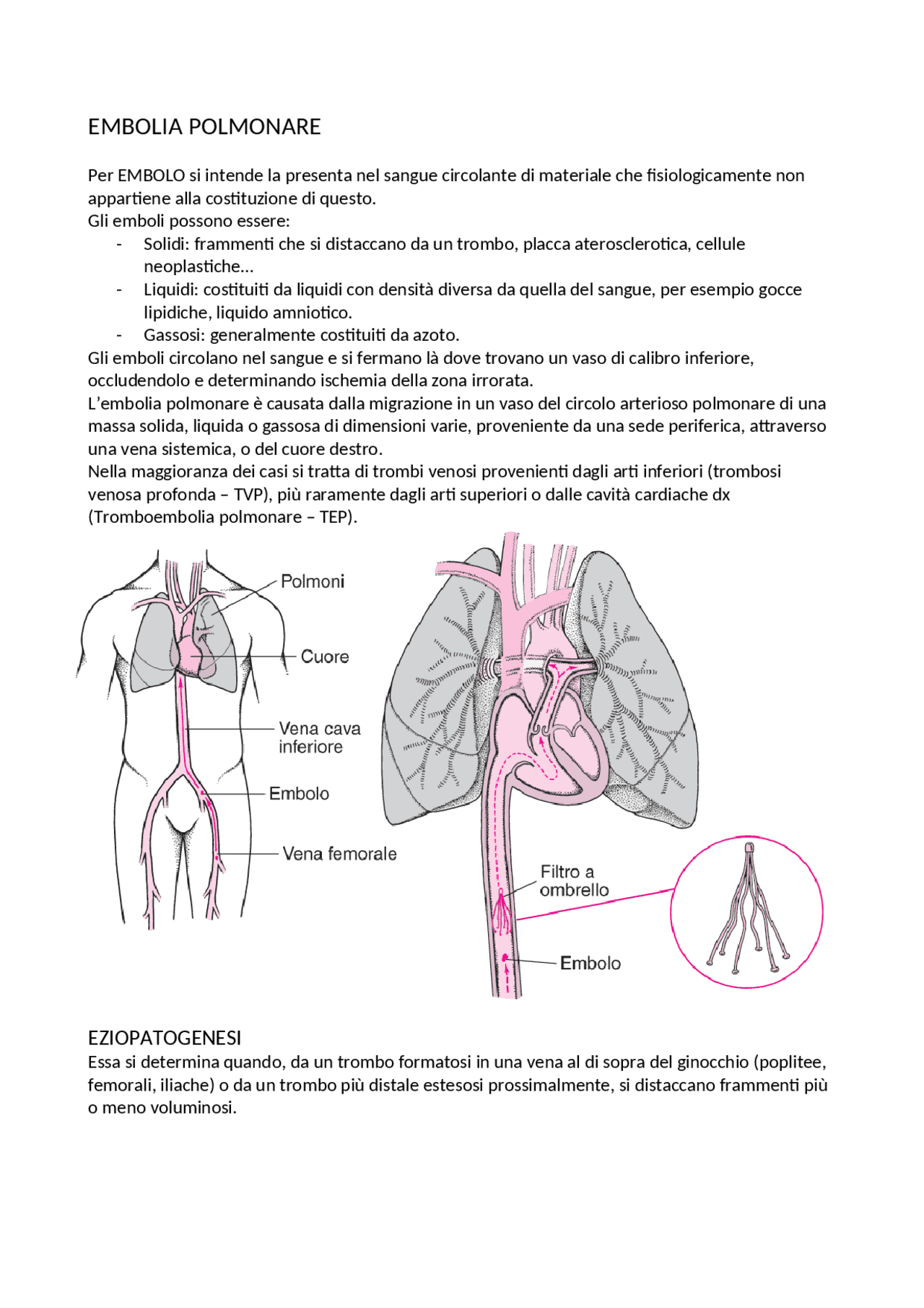 EMBOLIA POLMONARE: infermieristica area critica - Docsity