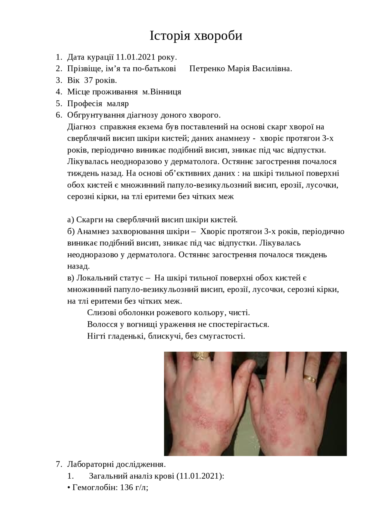 Справжня екзема історія хвороби Docsity