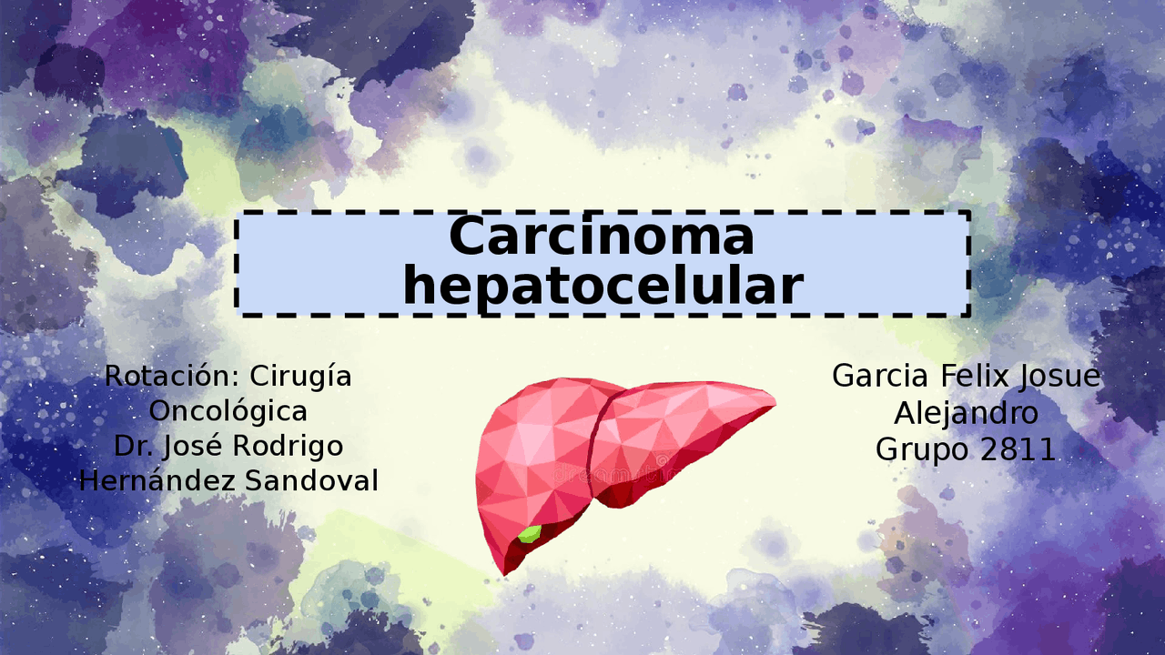 Carcinoma Hepatocelular Diapositivas De Oncología Docsity