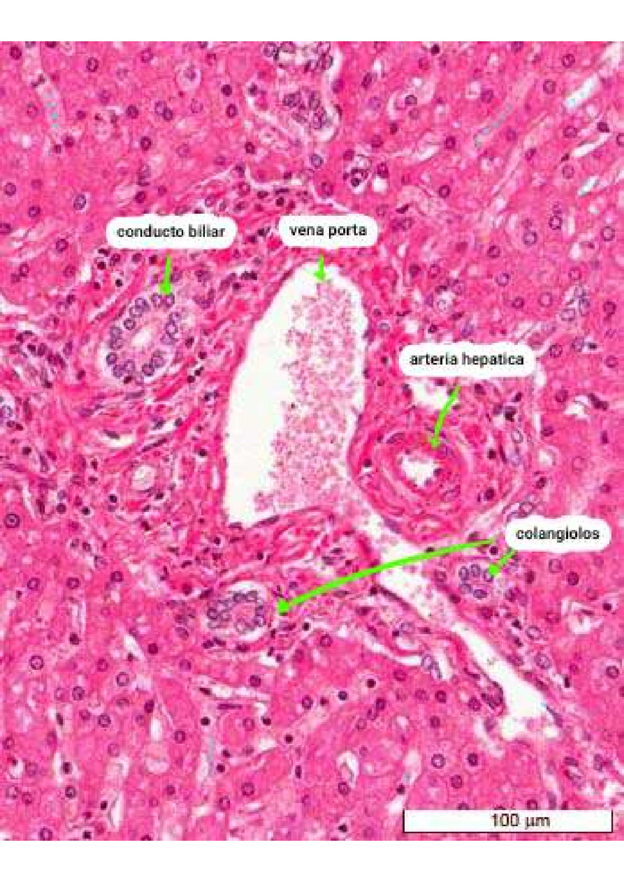 Rotulación histología hígado | Esquemas y mapas conceptuales de ...