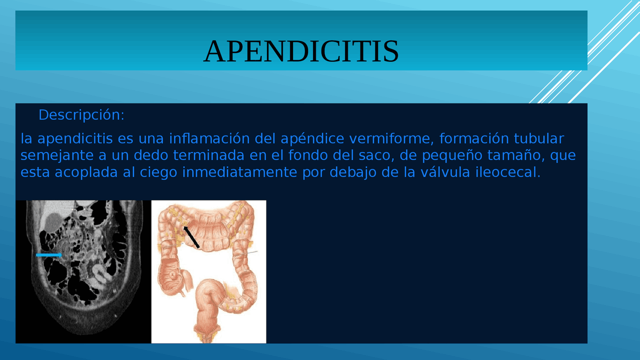 APENDICE PPT PRESENTACION - Docsity