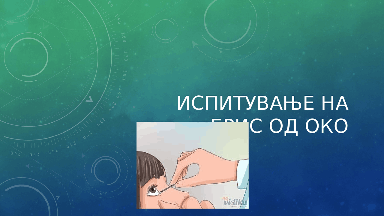 Kako pravilno uyeti bris iz oka | Beleške' predlog Biologija - Docsity