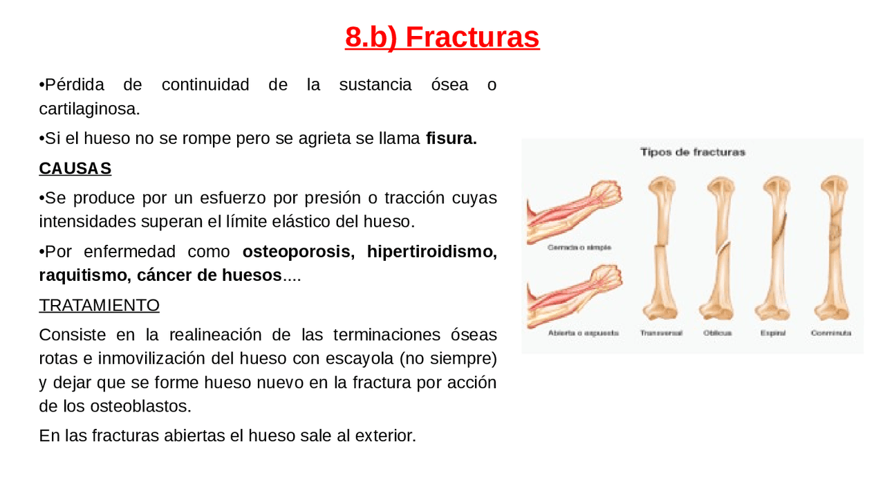 Diapositivas Sistema óseo Docsity
