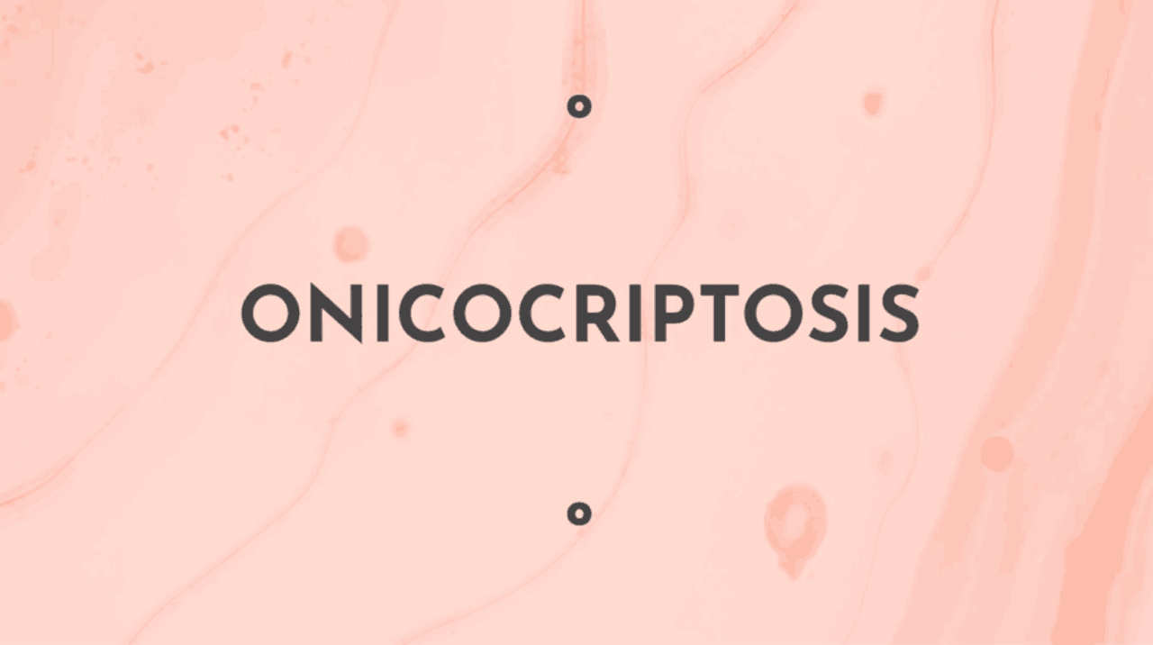 ONICOCRIPTOSIS Y SUS ESTADIOS - Docsity