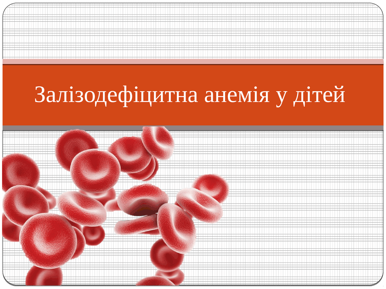 Залізодефіцитна анемія у дітей Презентации Педиатрия Docsity