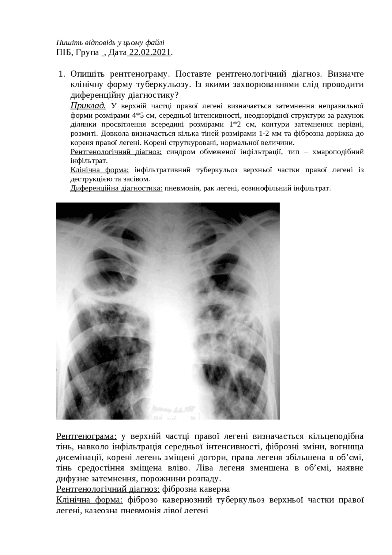 Самостоятельная работа по фтизиатрии Docsity