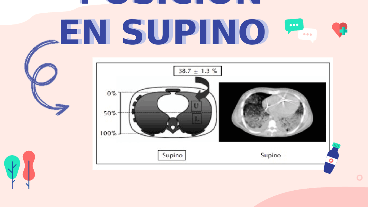 FISIOLOGIA DE LA POSICION EN PRONO PARA PACIENTE CON COVID - Docsity
