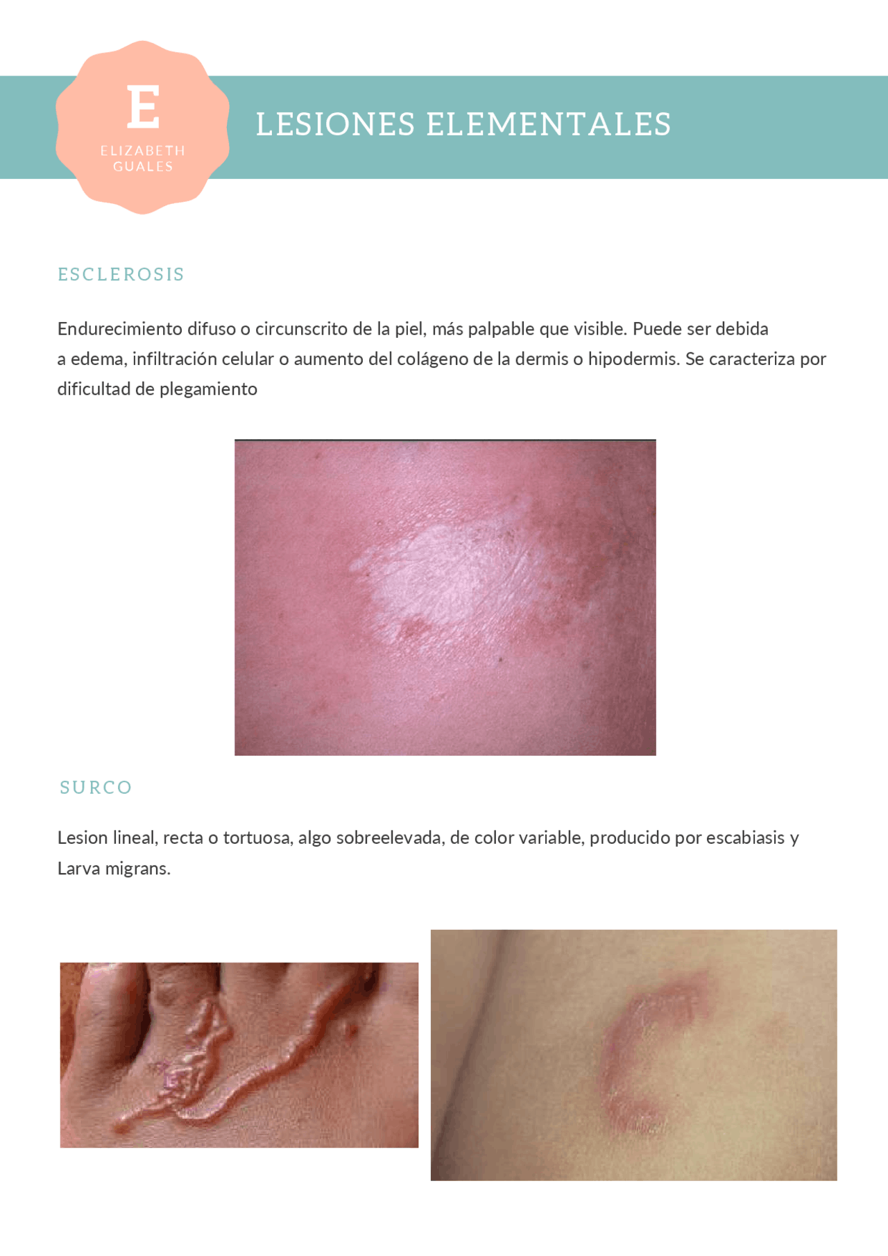 Lesiones elementales piel | Resúmenes de Dermatología | Docsity
